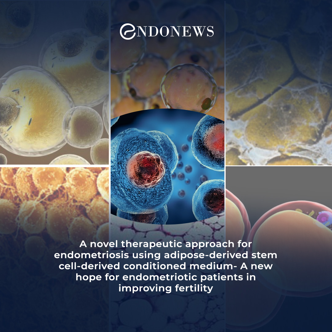 Conditioned Medium From Adipose Tissue Derived Stem Cells For