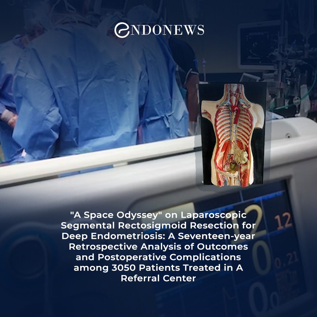 Postoperative outcomes of laparoscopic rectosigmoid resection for bowel ... Postoperative outcomes of laparoscopic rectosigmoid resection for bowel ...