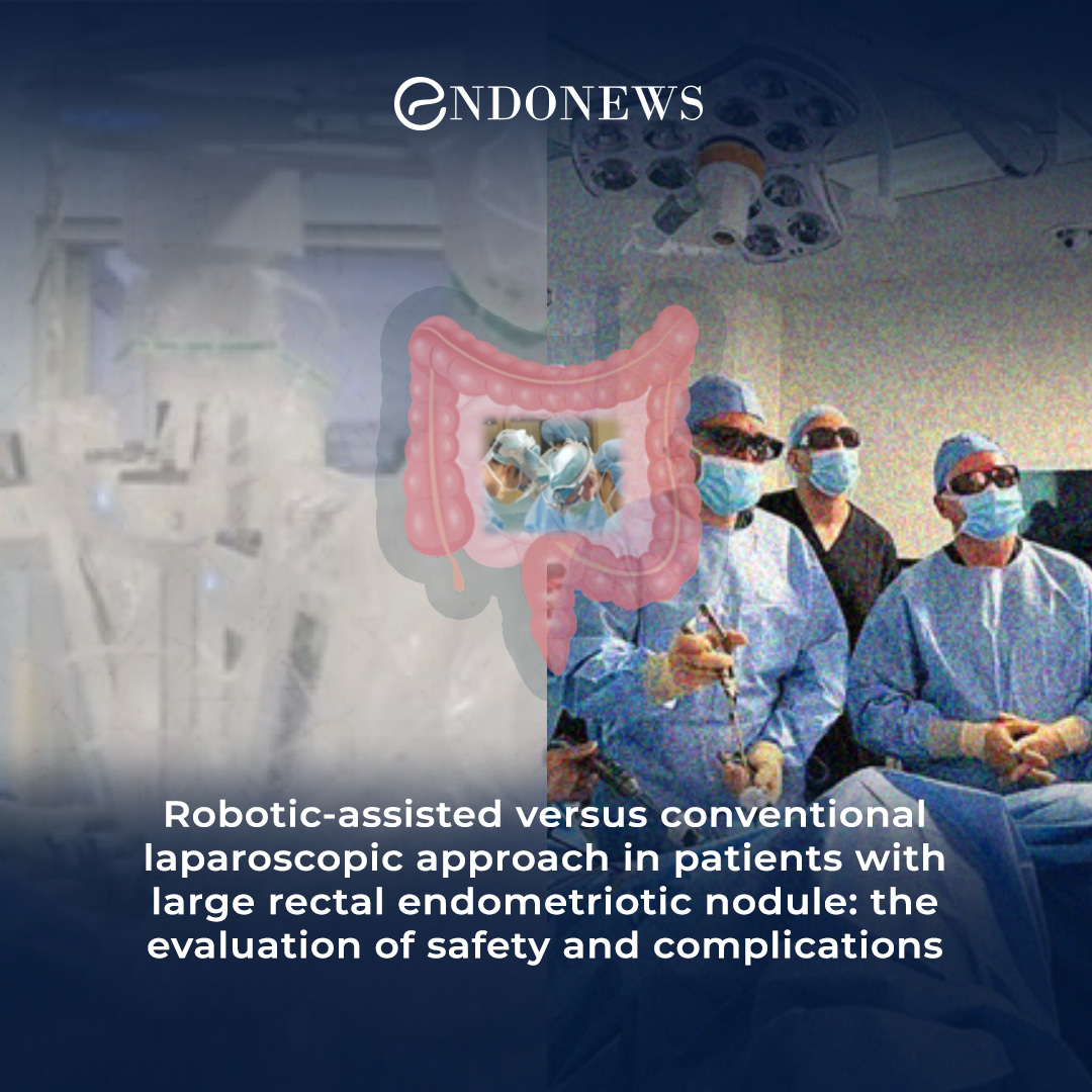 Robotic Surgery Not Linked With More Complications in Certain Cases ...