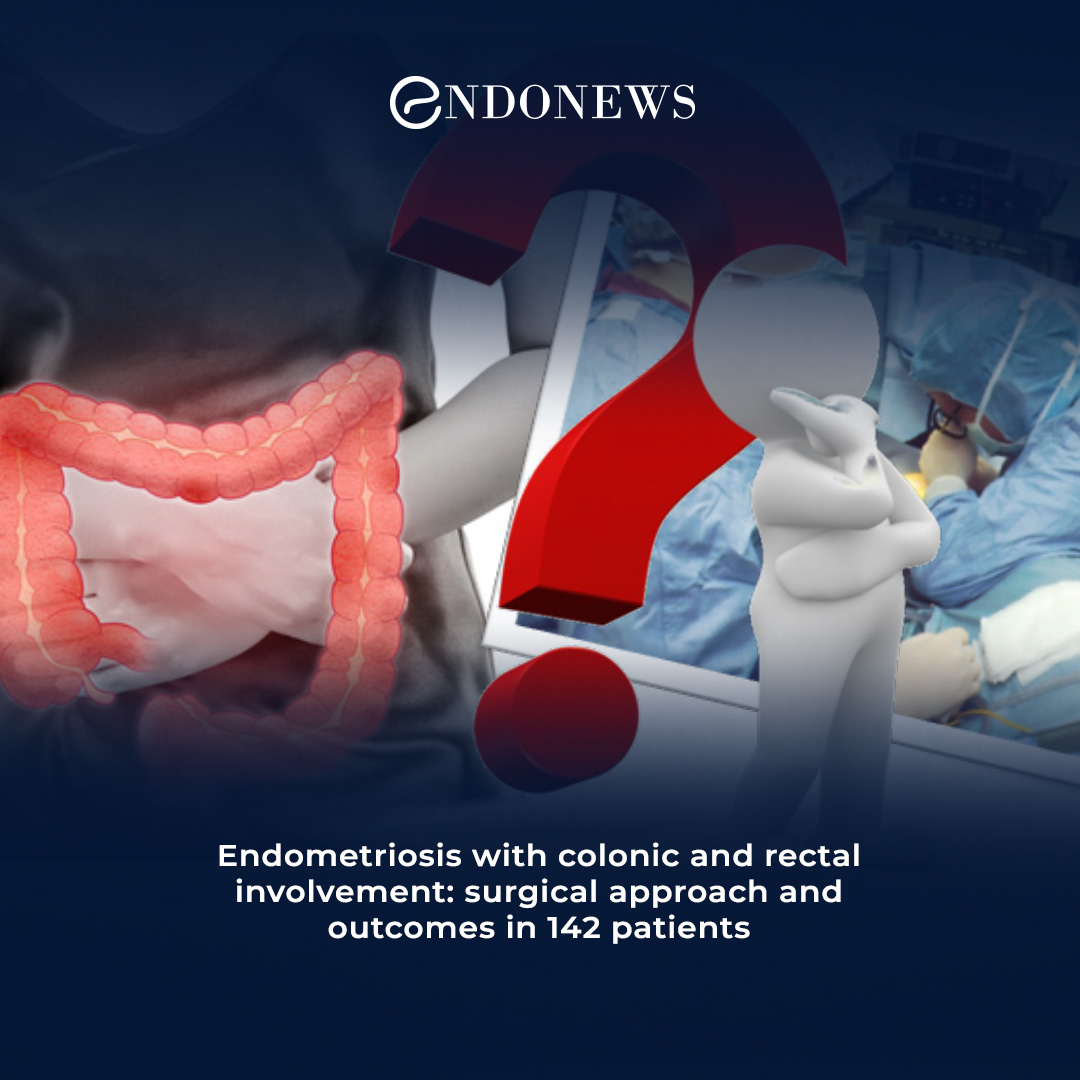 The type of surgical approach compared to complications and recurrence ...