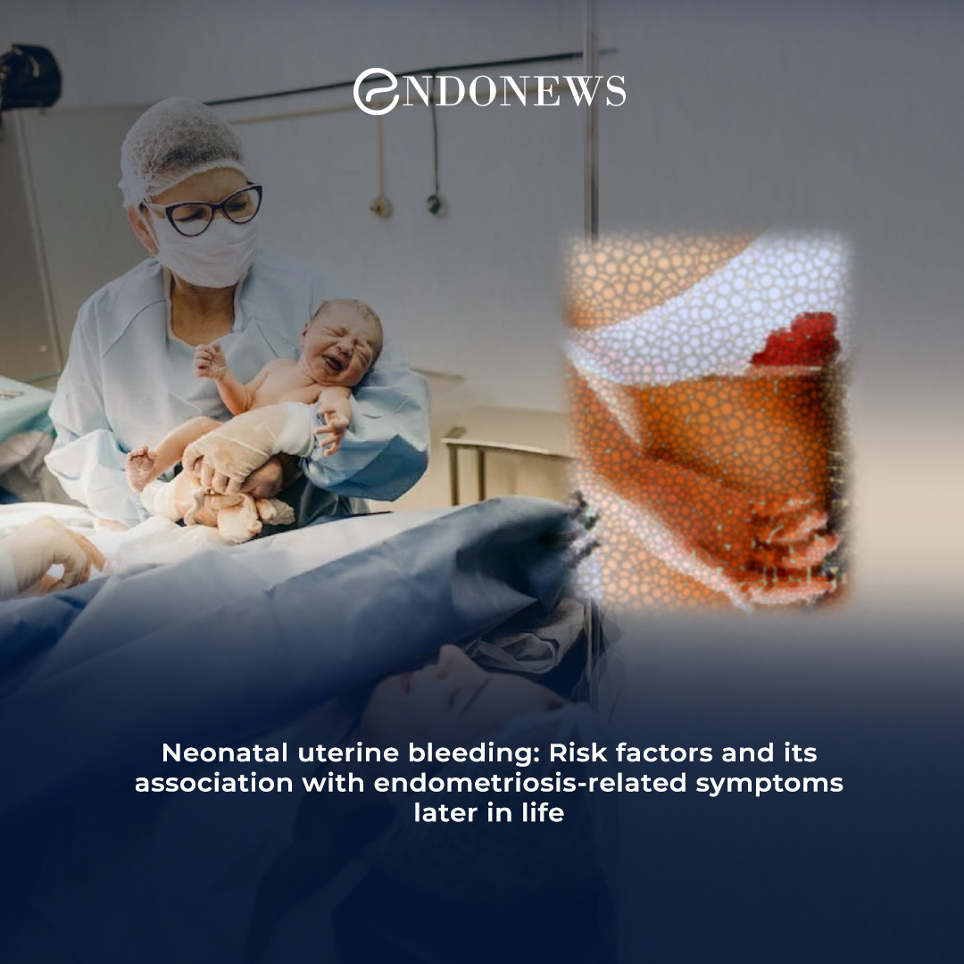 Neonatal uterine bleeding at birth and endometriosis later in life ...
