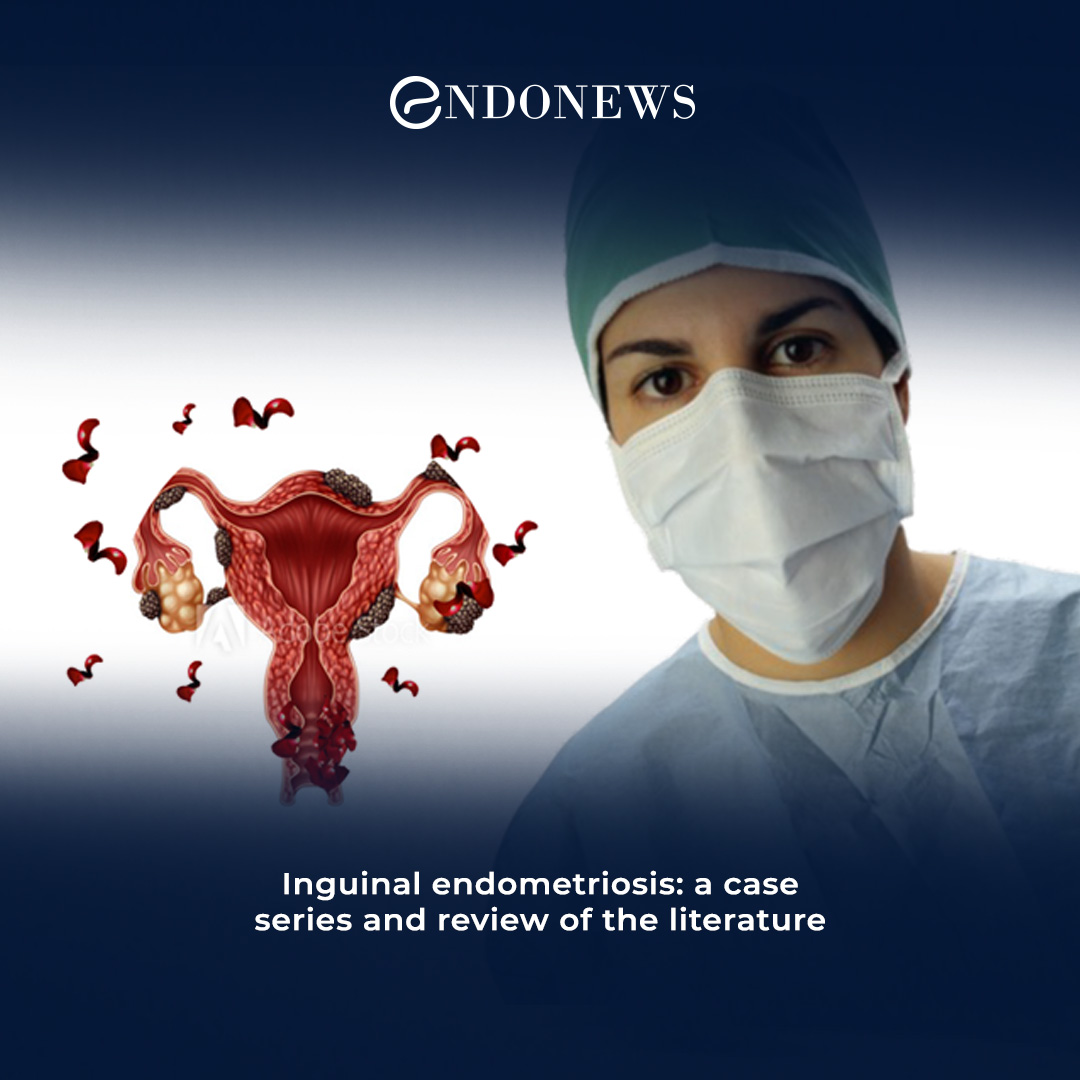 Inguinal endometriosis is a commonly neglected differential diagnosis ...