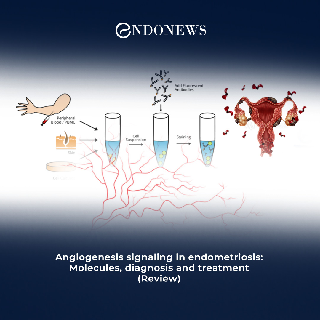 Hot research in endometriosis; new vessel formation: angiogenesis ...