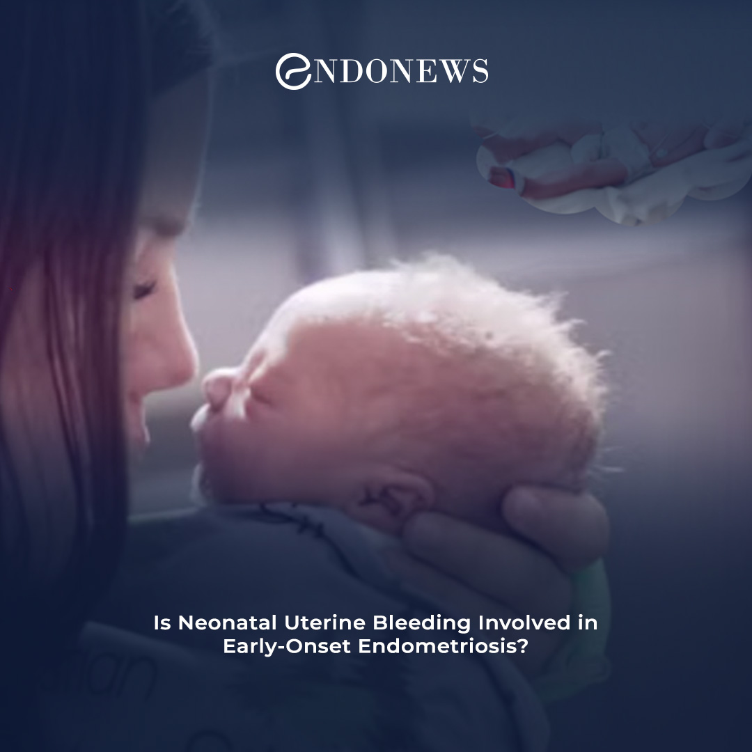 Any link between endometriosis and neonatal uterine bleeding? | EndoNews