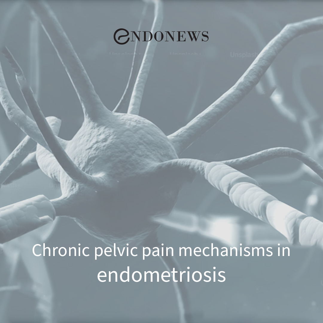 Chronic pelvic pain mechanisms in endometriosis | EndoNews