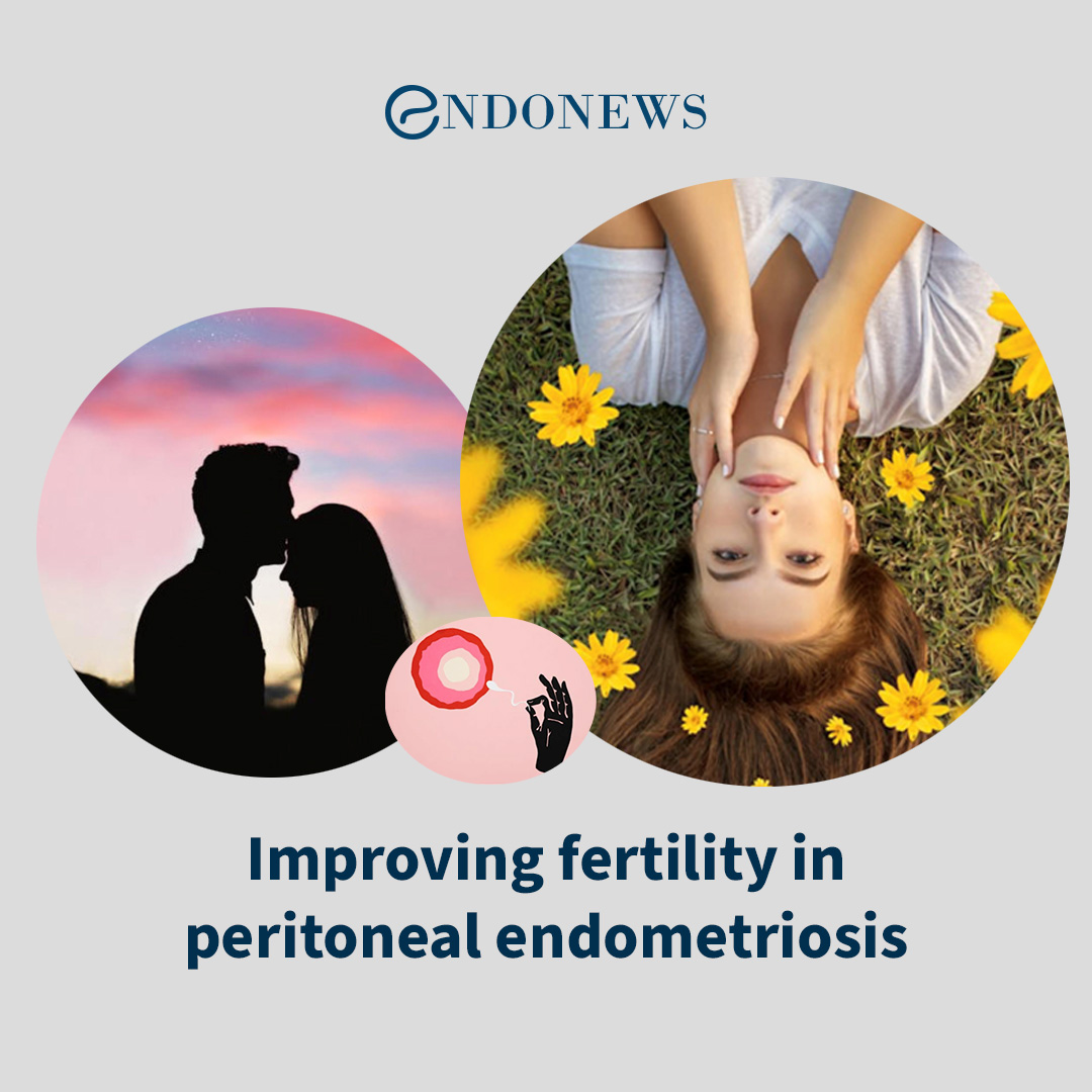 Improving fertility in peritoneal endometriosis | EndoNews