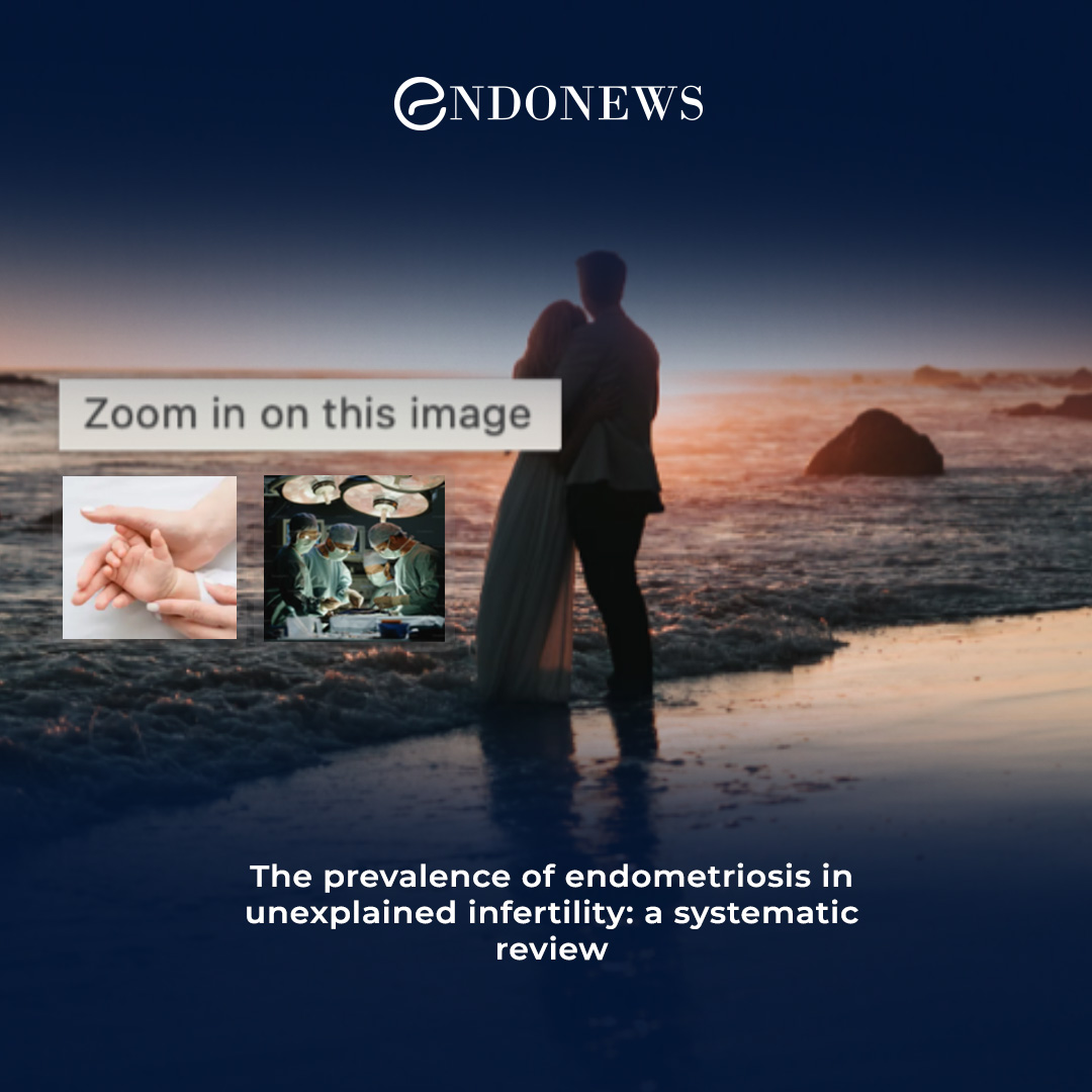 Endometriosis Prevalence High Among Women With Unexplained Infertility | EndoNews