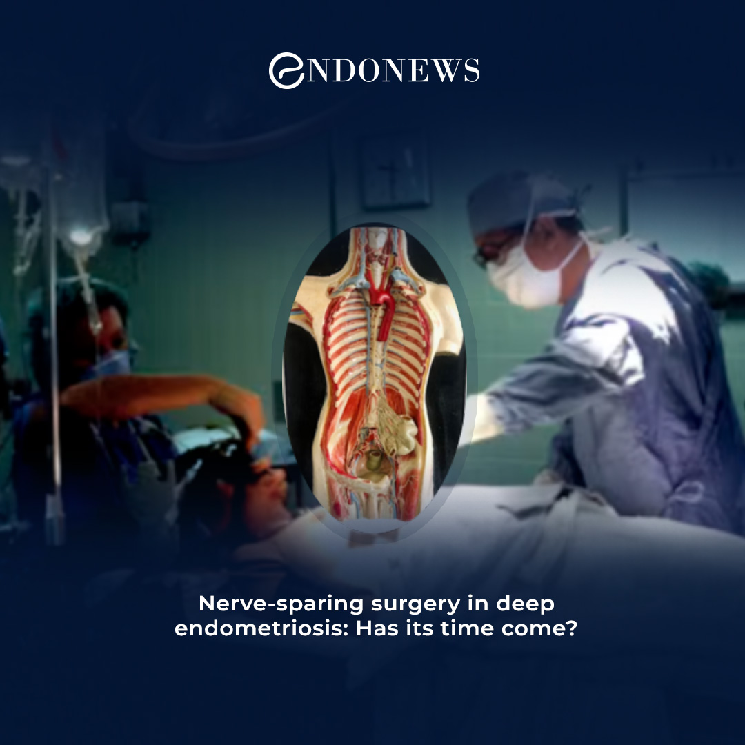 Why we should prefer nerve-sparing surgery in deep endometriosis ...