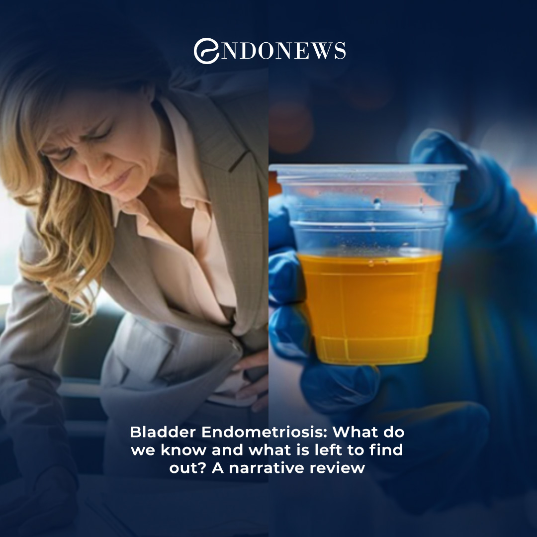 Bladder Endometriosis: Current Knowledge and Future Directions | EndoNews Bladder Endometriosis: Current Knowledge and Future Directions | EndoNews