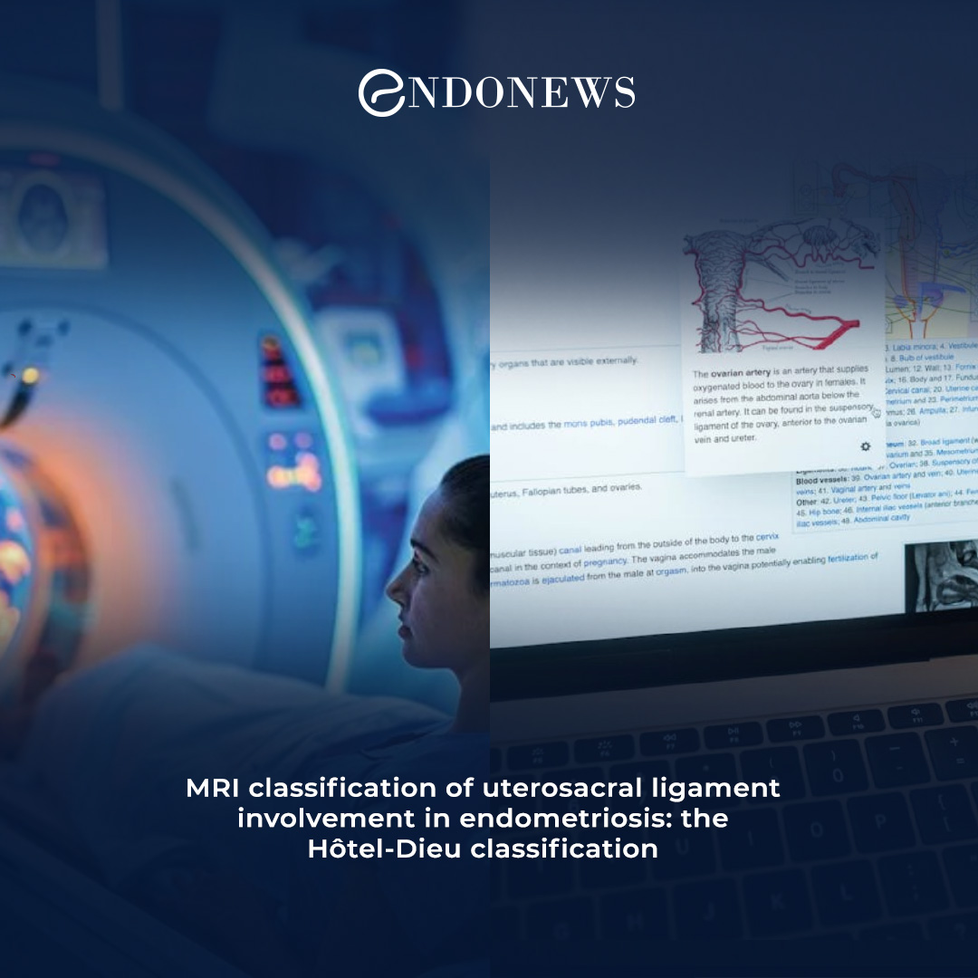 Non-invasive MRI Based Detection of Uterosacral Deep Infiltrating ...