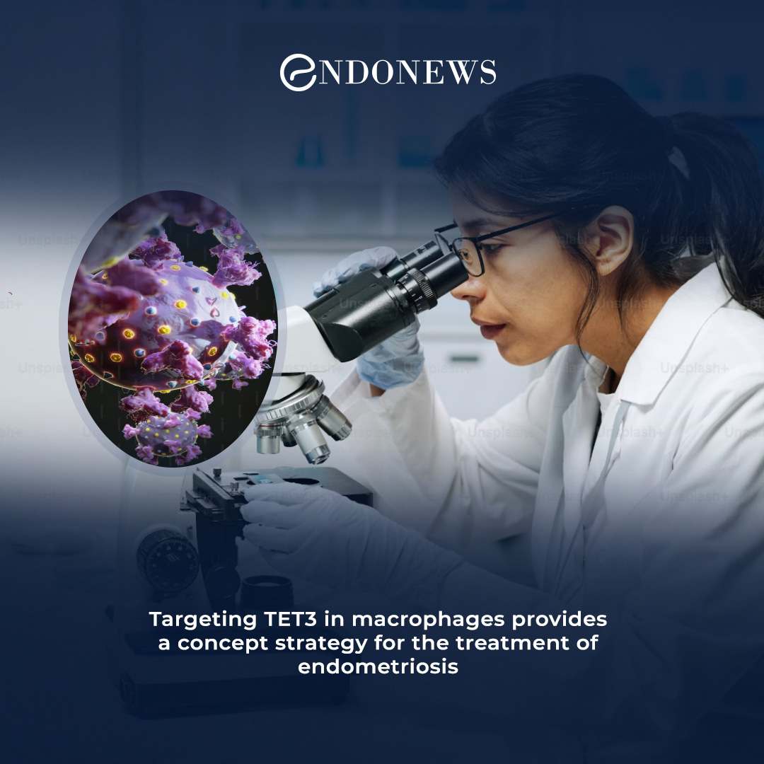 TET3: A new target for endometriosis treatment | EndoNews
