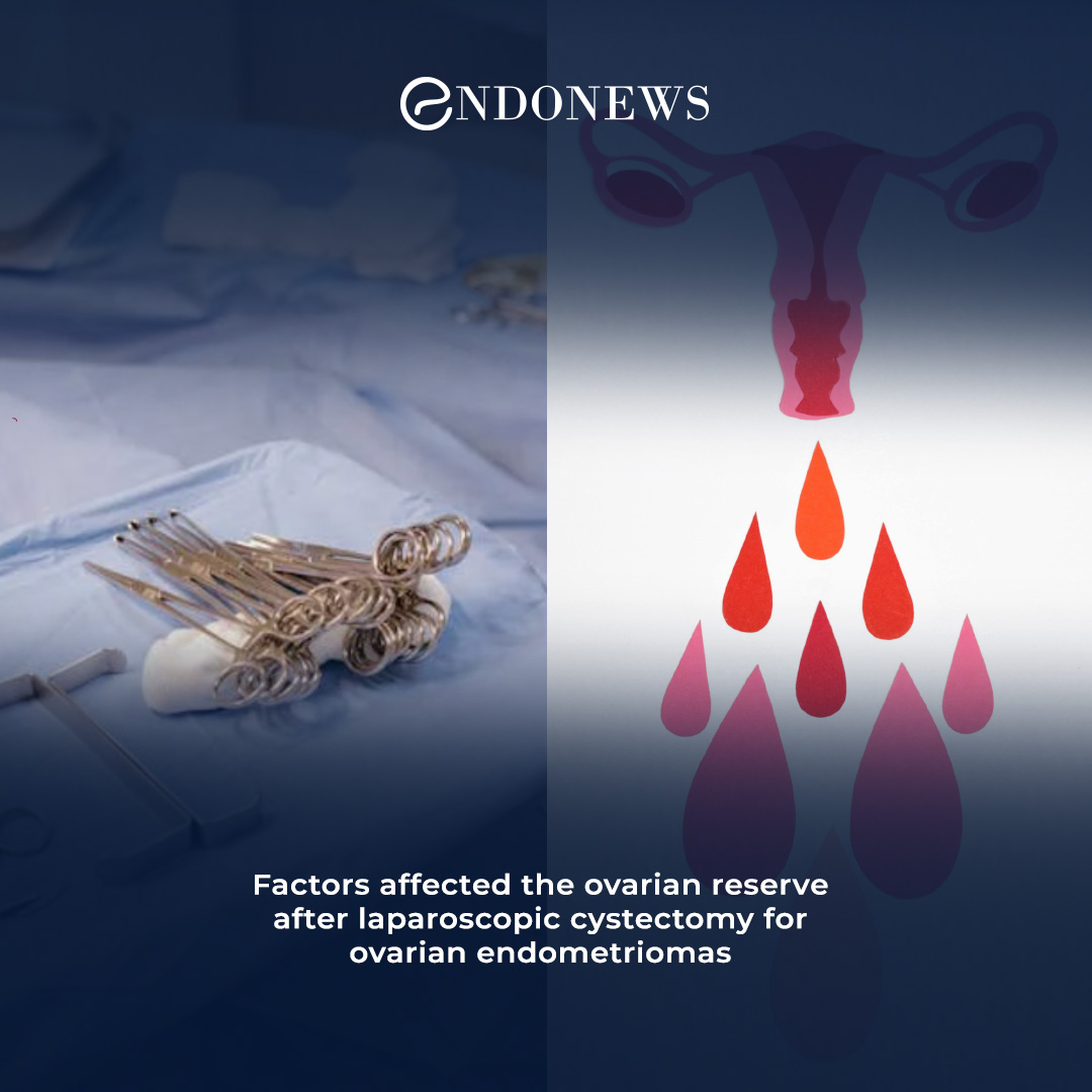Predictive factors for decline in postoperative serum AMH levels ...