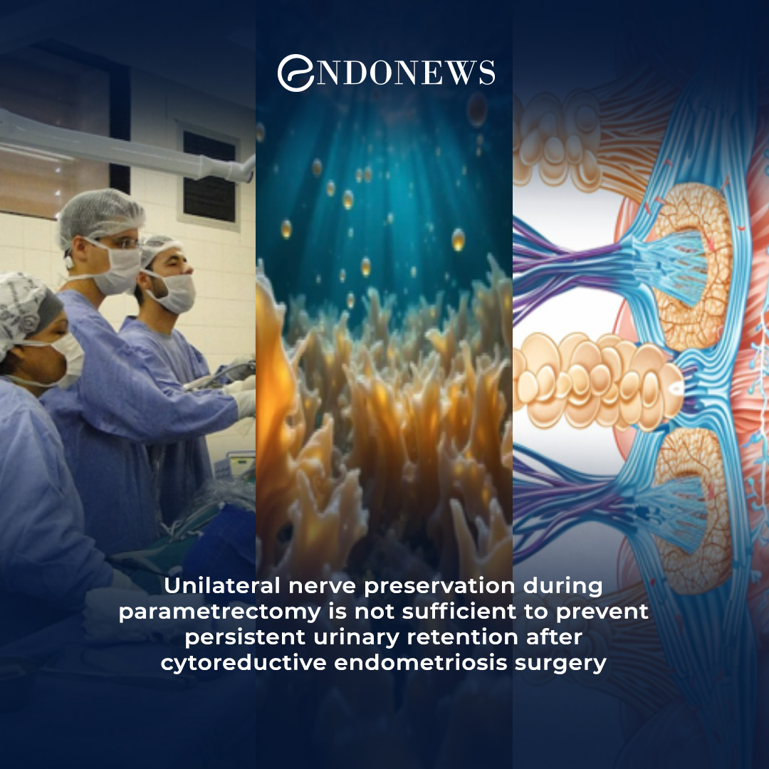 Impact of Nerve Preservation During Parametrectomy on Urinary Retention ...