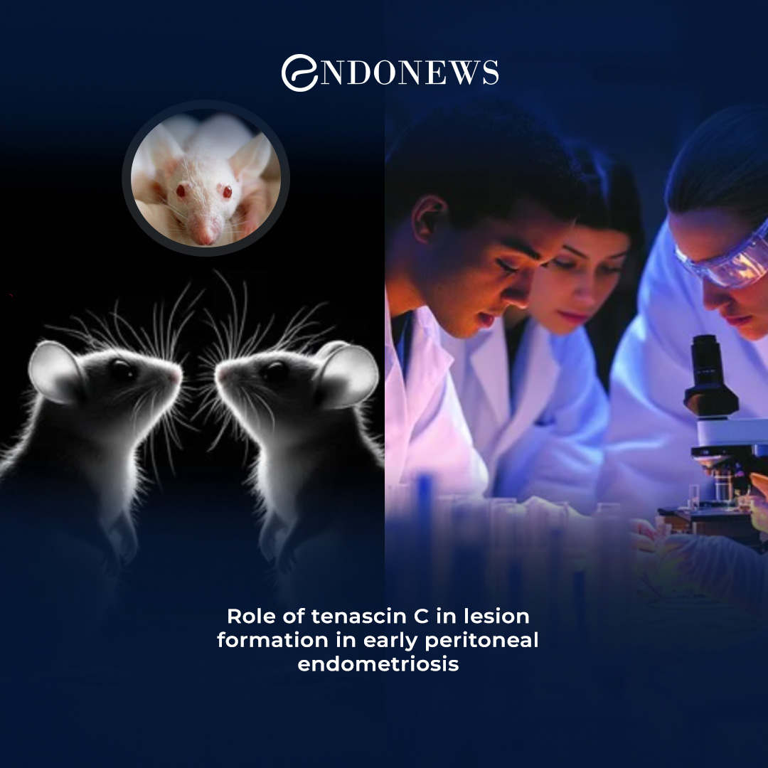 Tenascin C as a Crucial Player in Peritoneal Endometriosis Pathogenesis ...