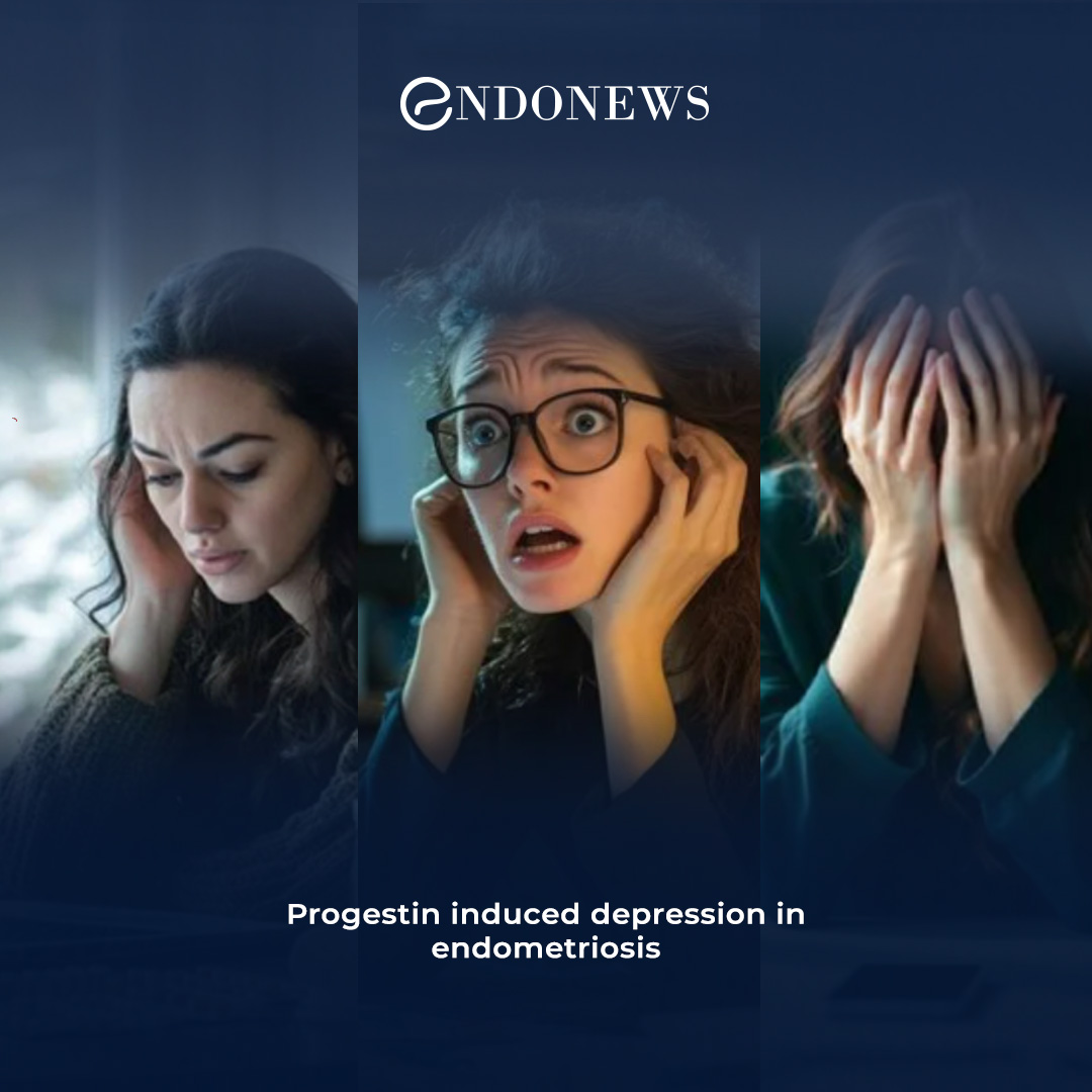 Impact of OC-Induced Mood Lability on Treatment Adherence in ...