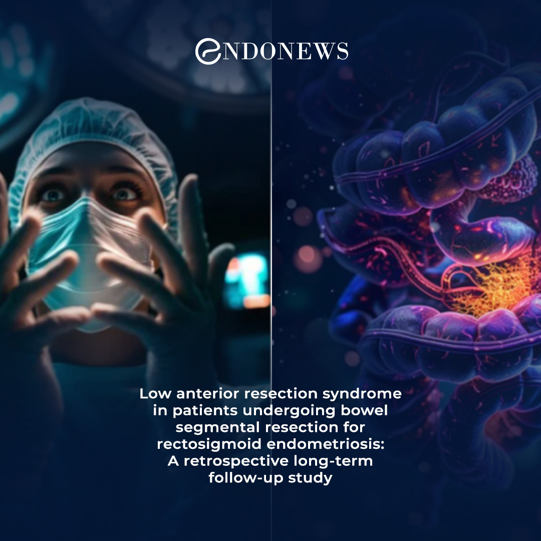 Low Anterior Resection Syndrome (LARS) Risk Following Rectosigmoid ...