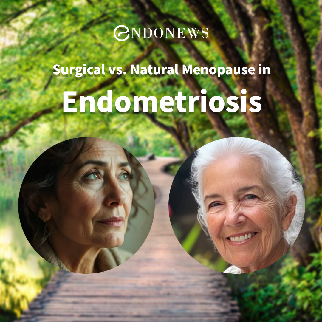 Surgical vs. Natural Menopause in Endometriosis | EndoNews