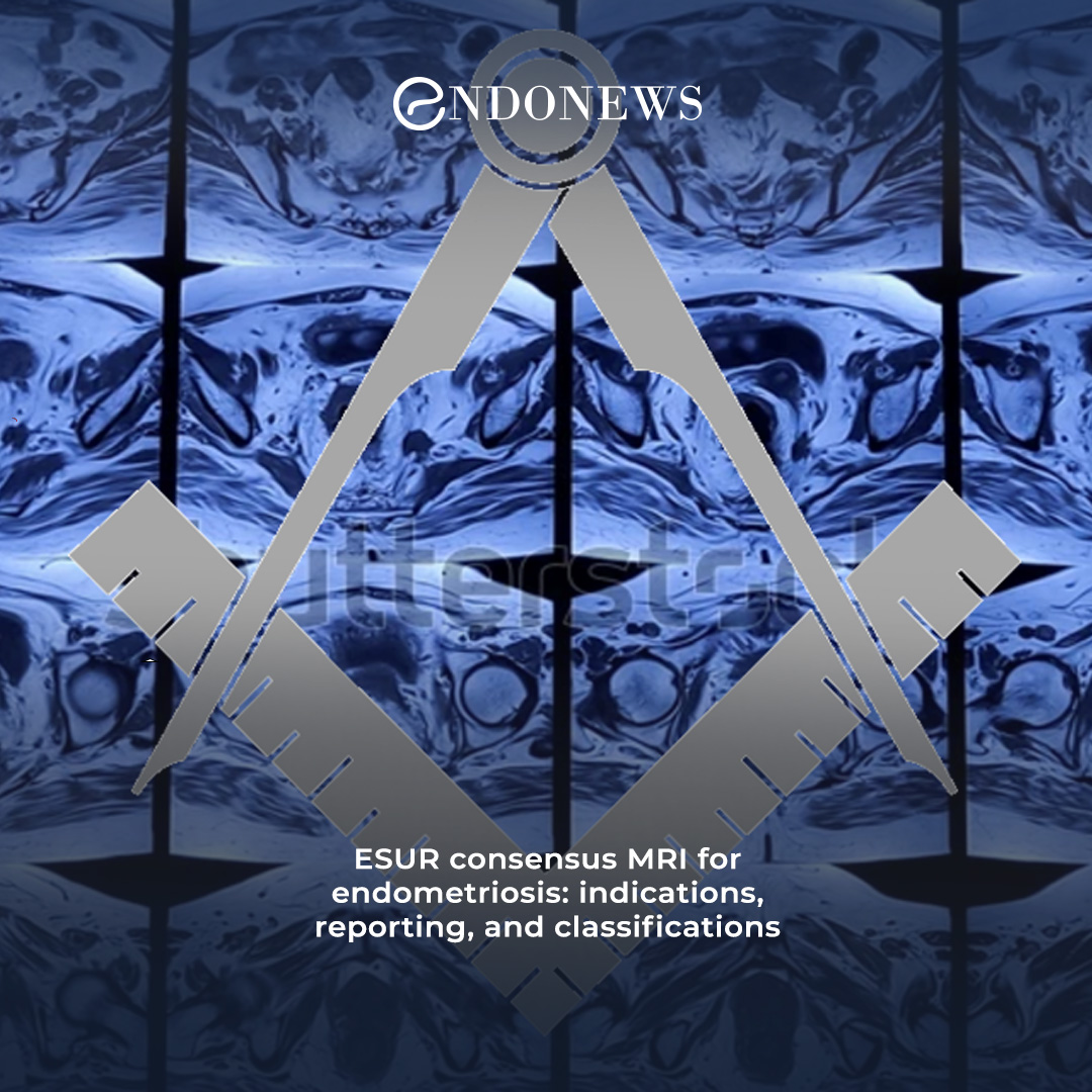 ESUR Experts Redefine MRI Standards in Endometriosis | EndoNews