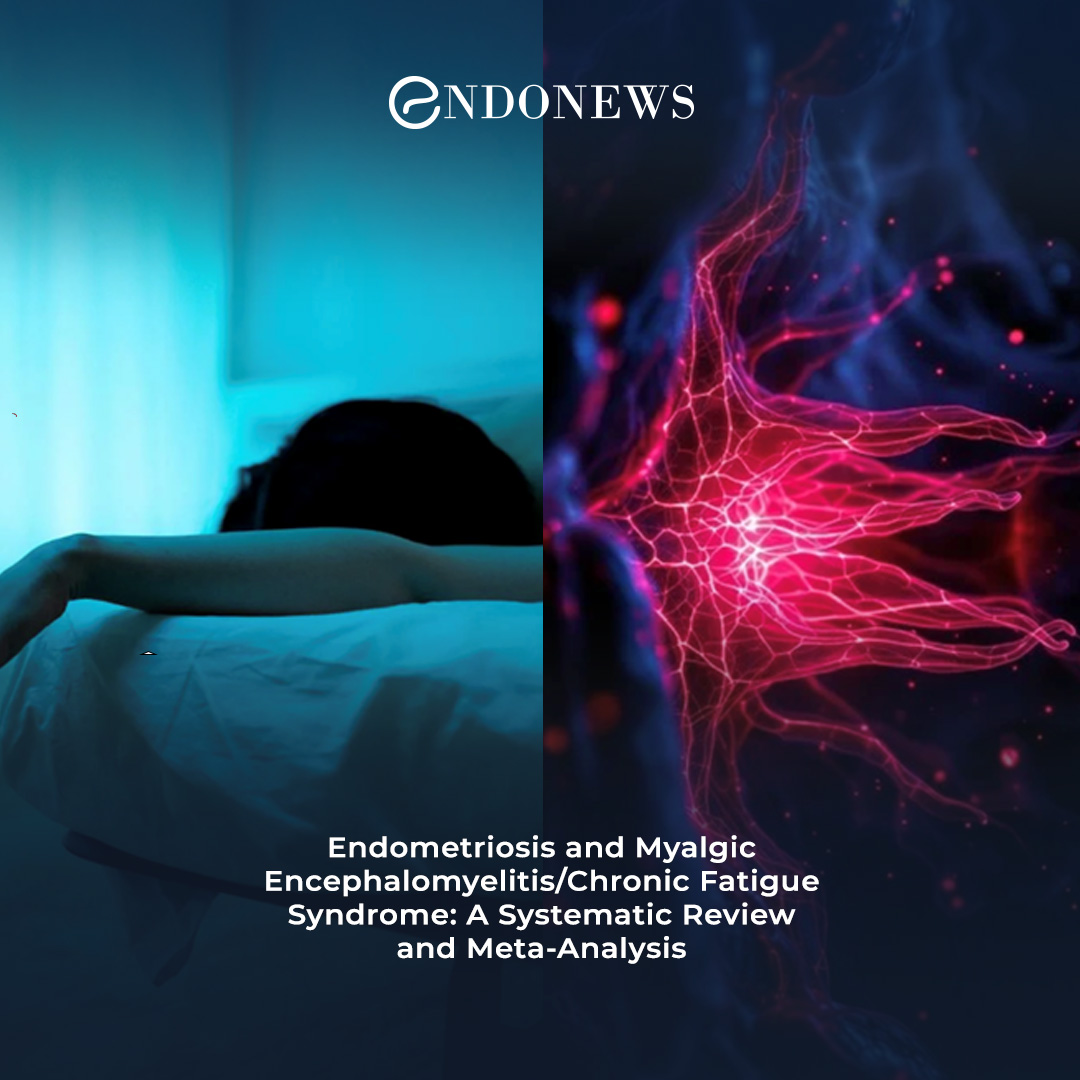 Endometriosis and Myalgic Encephalomyelitis-Chronic Fatigue Syndrome ...